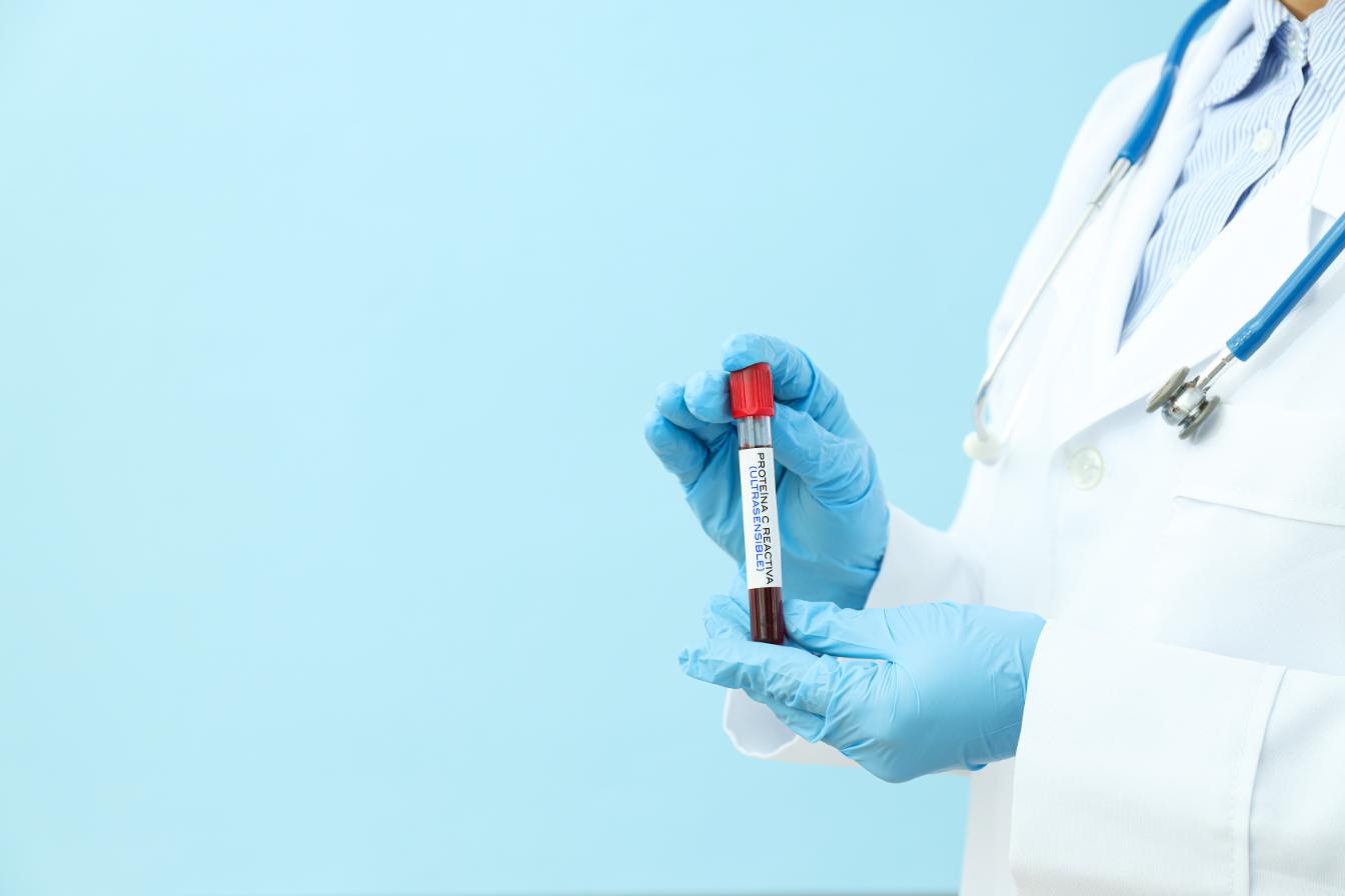 Proteína C reactiva (ultrasensible) – LEDEZLAB